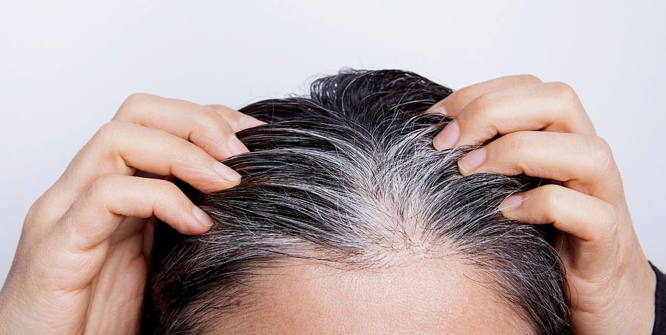 Canas: por qué aparecen y cómo podemos prevenirlas